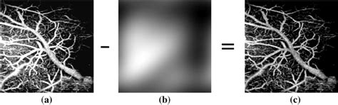 smoothed result of the oct angiogram and the process of acquiring the