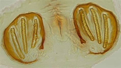 Posterior Spiracle Of Larva 20x Download Scientific Diagram