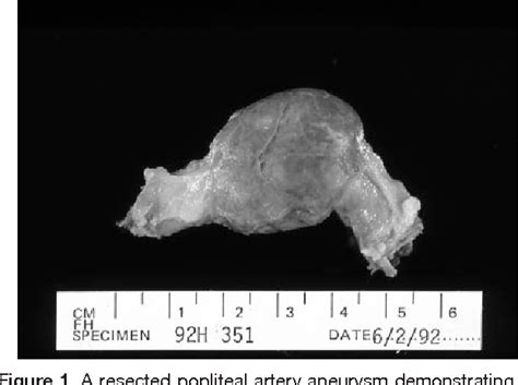 Structure Of Sciatic Artery Semantic Scholar
