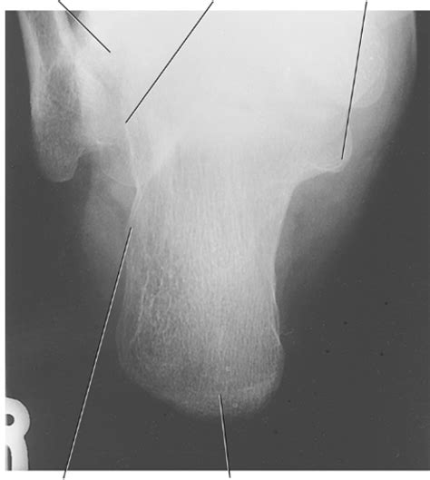 Lower Extremities Diagram Quizlet