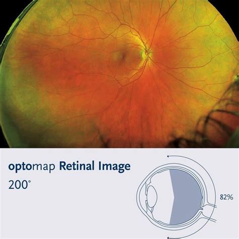 Introducing Our New Optomap Scan