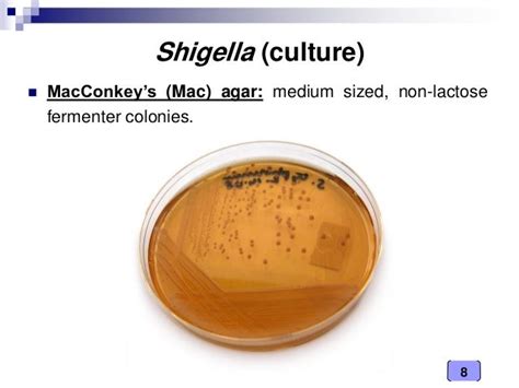 Medical Microbiology Laboratory Enterobacteriaceae Iv