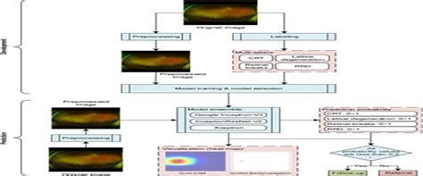 Automatic Detection Of Peripheral Retinal Lesions From Ultra The Asia Pacific Journal Of