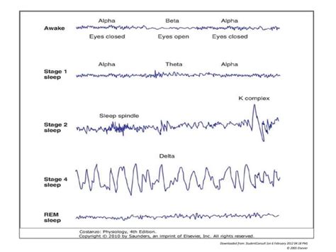 Eeg Sleeppptx