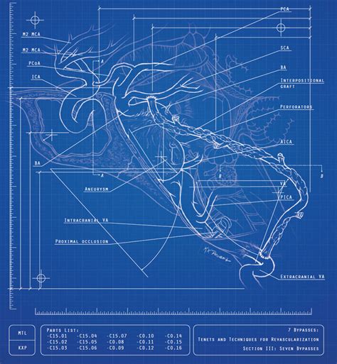 Extracranial Intracranial Bypass With Interposition Graft Neupsy Key