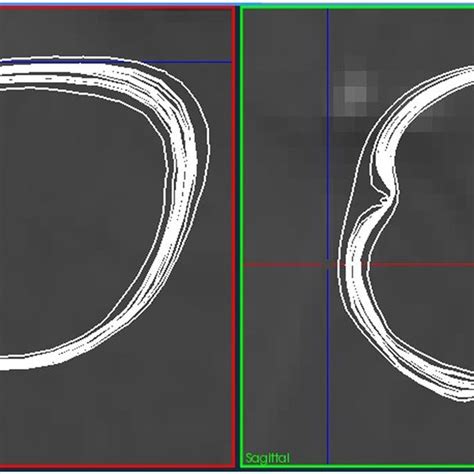 A Simulation Ensemble Generated From The Parameter Space Sampling