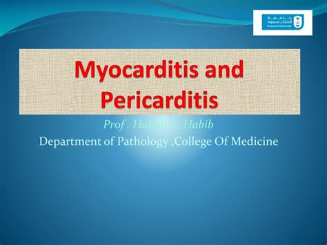 Ppt Myocarditis And Pericarditis Powerpoint Presentation Free Download Id 351314