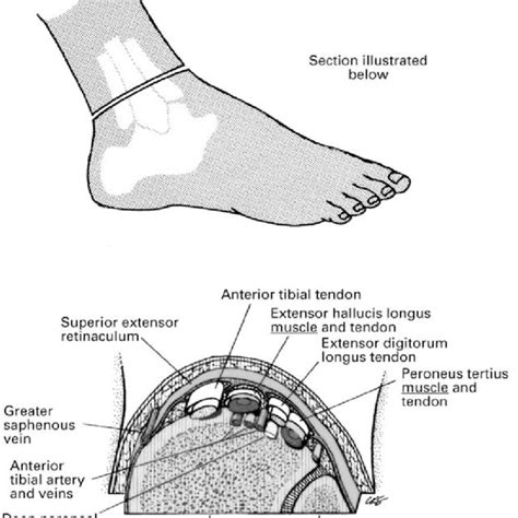 Pdf Extensor Retinaculum Syndrome Of The Ankle After Injury To The