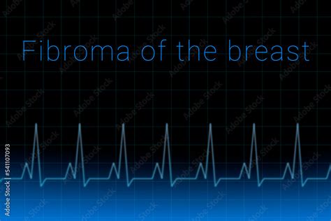 Fibroma Of The Breast Disease Fibroma Of The Breast Logo On A Dark Background Heartbeat Line