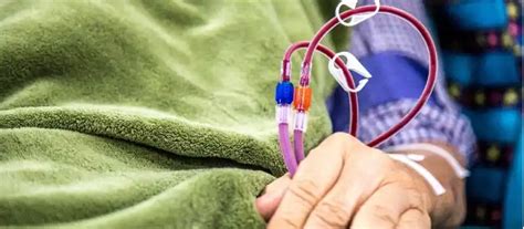 What Is Home Hemodialysis SKI