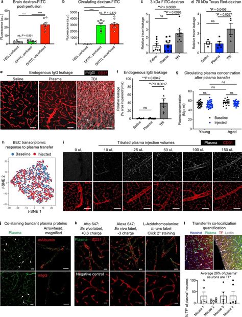 Bbb Permeability And Homeostasis After Plasma Injections And Brain Download Scientific Diagram