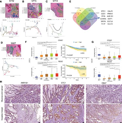Cell Differentiation Trajectories In Crc Obtained By Pseudotime