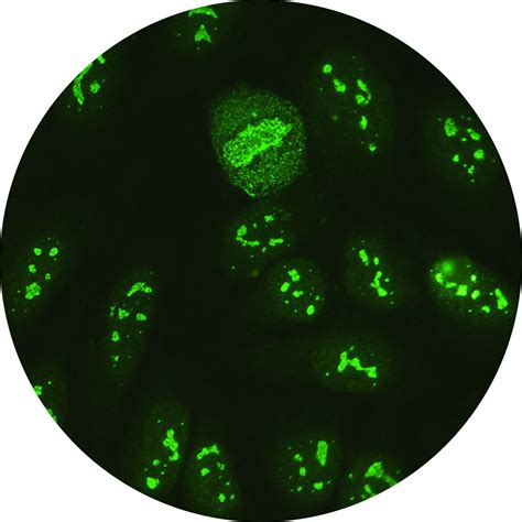Patterns Classification