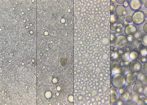 My Breastmilk Under A Microscope Rexclusivelypumping