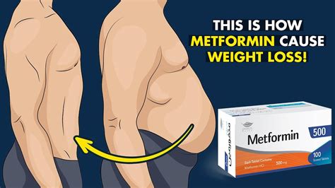 Does Metformin Help You Lose Weight Exploring The Potential Benefits