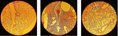 Masson Trichrome Staining Of The Lung Specimens From One Mouse Download Scientific Diagram