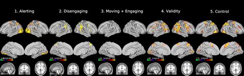 Group Level Activation Maps Surface Data Of The Five Contrasts All