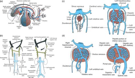 Portacaval Anastomosis Diagram
