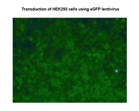 Enhanced Gfp Lentivirus Puromycin