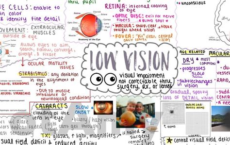 Anatomy Of Vision And Low Vision One Page Outline Concept Map Etsy