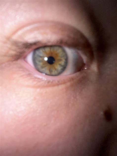Do I Have Ch Hazel Green Idk Anymore 😭 Rheterochromia