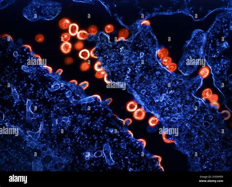 Transmission Electron Micrograph Of Hiv 1 Virus Particles Red Budding