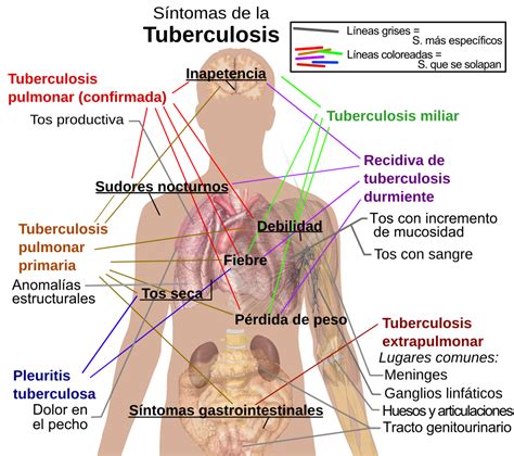 Filetuberculosis Symptoms Essvg Wikimedia Commons