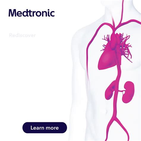 The Tourguide™ Steerable Sheath Offers Versatility And Precision