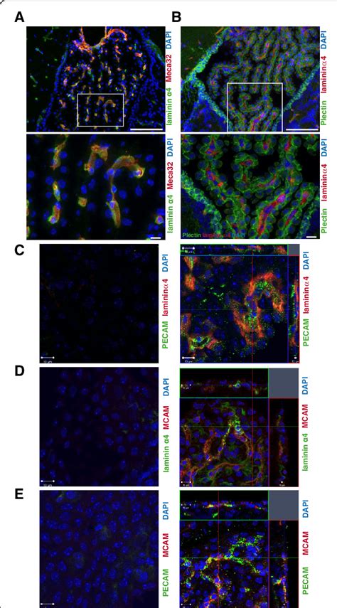 Laminin 4 Localization To Choroid Plexus Endothelial Basement Download Scientific Diagram