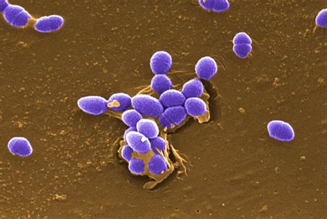 Gambar Gratis Besar Angka Gram Positif Enterococcus Faecalis Bakteri Gambar Gratis Besar Angka Gram Positif Enterococcus Faecalis Bakteri