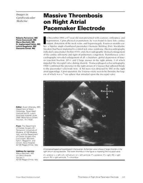 Pdf Massive Thrombosis On Right Atrial Pacemaker Electrode