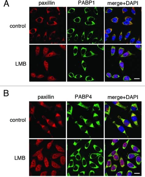 Figure 5 Nuclear Export Of Pabp1 And Pabp4 Is Not Pre Open I