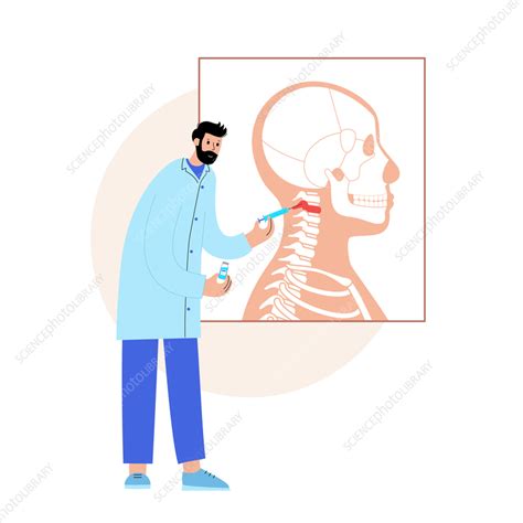 Spinal Injection Illustration Stock Image F0365579 Science Photo Library