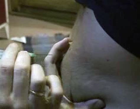 Details Of An Intramuscular Injection 日本語で