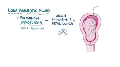 Potter Sequence Alchetron The Free Social Encyclopedia