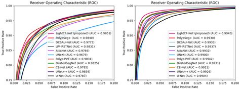 Lightcf Net A Lightweight Long Range Context Fusion Network For Real Time Polyp Segmentation