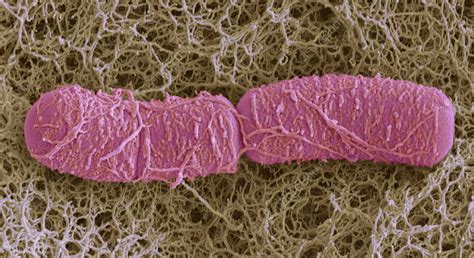 Ear Bacteria Sem Stock Image C058 1696 Science Photo Library