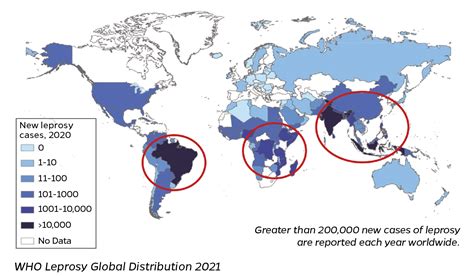 Who Leprosy Global Distribution 2021 Explore Magazine