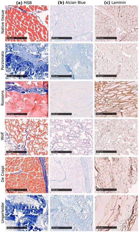 Histological Analysis Of Ecm Components Of Native And Decellularized Download Scientific