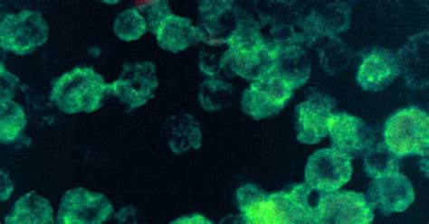 Deadly Brain Eating Bug Discovered In Towns Water Supply World News