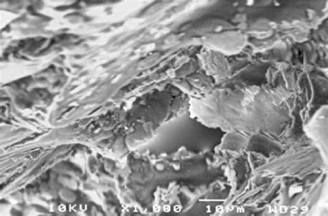 Extracellular Matrix With Embedded Microorganisms From Patient 1
