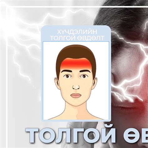 ТАНЫТОЛГОЙӨВДӨЖБАЙНАУУ 🧠 Баярмед мэдрэлийн эмнэлэг Facebook