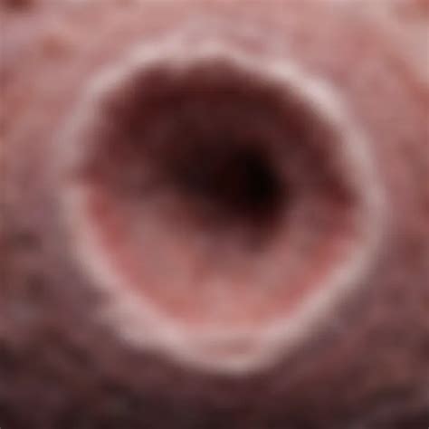 Microscopic Examination Of Malignant Neoplasm