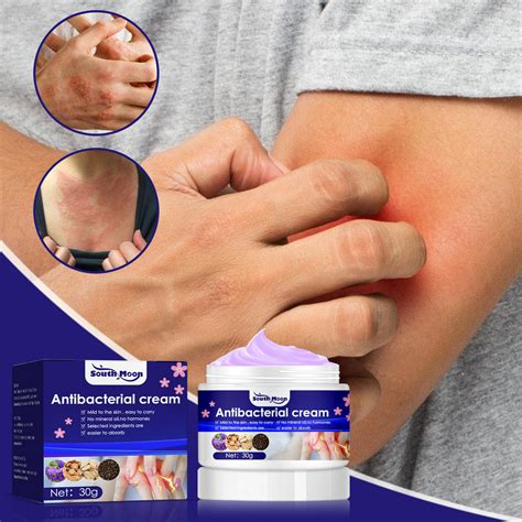 Eczema Psoriasis Treatment Cream Anti Itching Reduces Skin Rashes