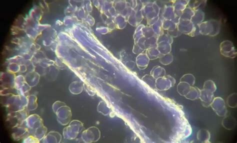 Israel Whats In The ‘unjabbed Blood Dr Yanowitz Explore Every