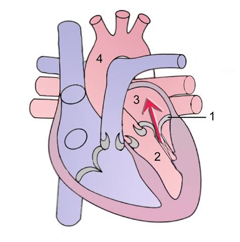 Mitral Insufficiency Alchetron The Free Social Encyclopedia