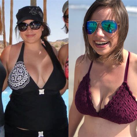 Weight Loss Breast Size Before And After At Amy Dillon Blog