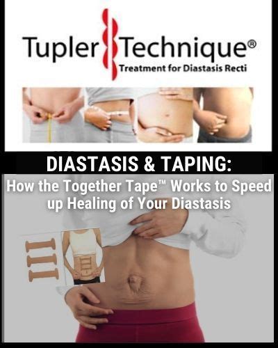 Diastasis And Taping How The Together Tape™ Works To Speed Up Healing O