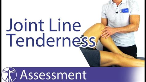 Joint Line Tenderness Palpation Meniscus Tear Youtube