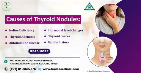Thyroid Nodules Causes Signs And Expert Treatment Options